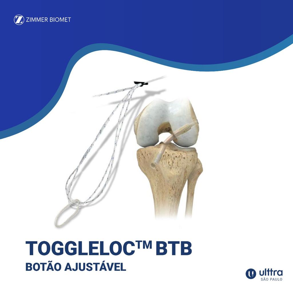 Botão ajustável Toggleloc™ BTB - Ulttra